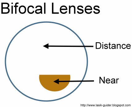 Eyeglasses - Spectacles